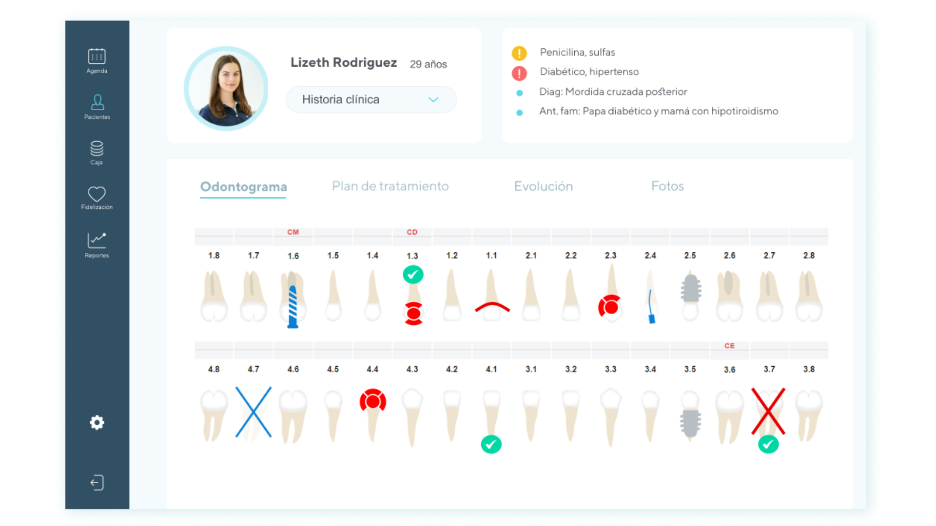 Odontograma digital y sus beneficios